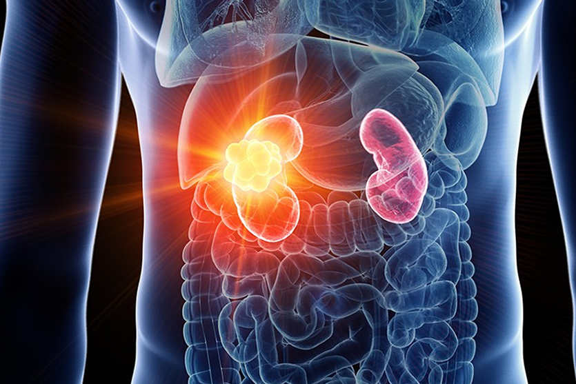 Néphrologie | Polyclinique Nour